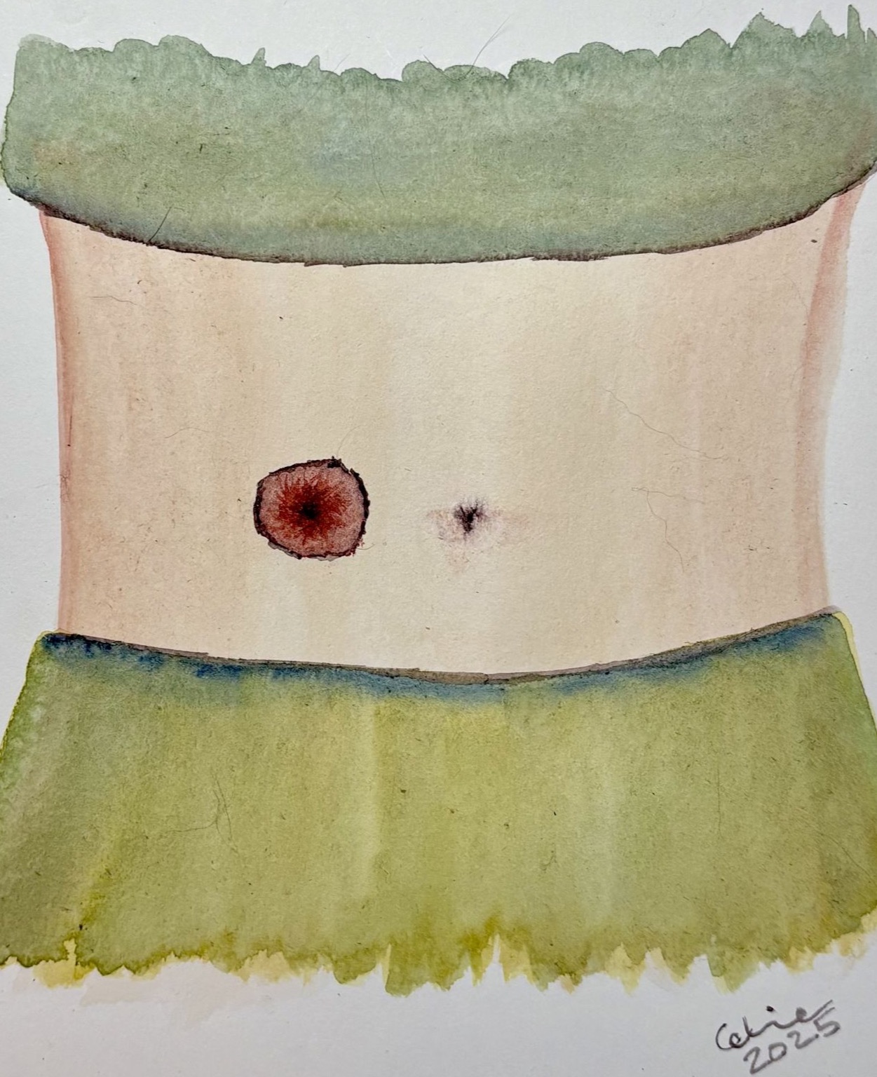 Ernährung mit Stoma - Stoma-Welt